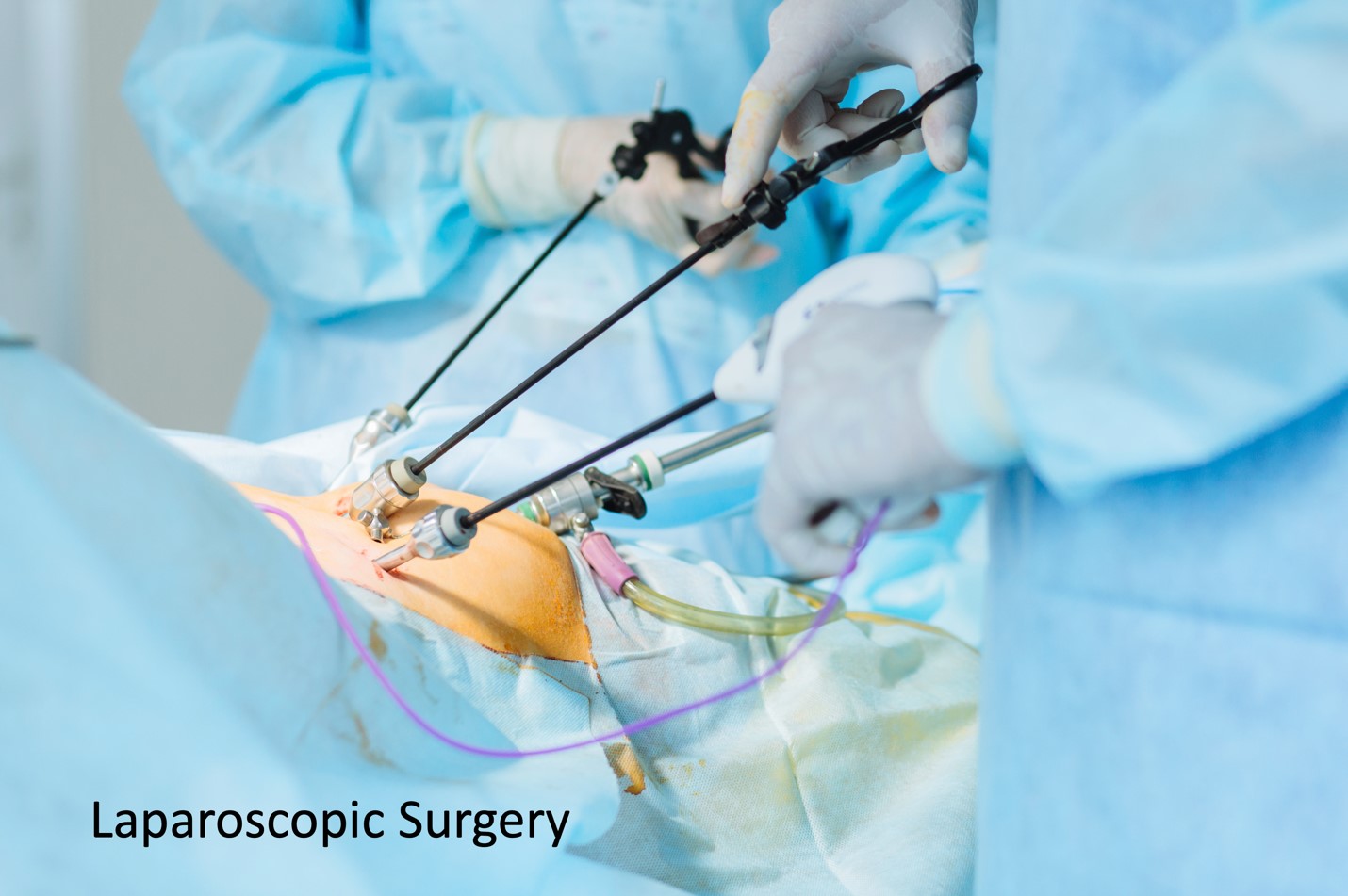 Laparoscopic Cholecystectomy In Singapore LS Lee Surgery Clinic Laparoscopic Cholecystectomy In Singapore LS Lee Surgery Clinic