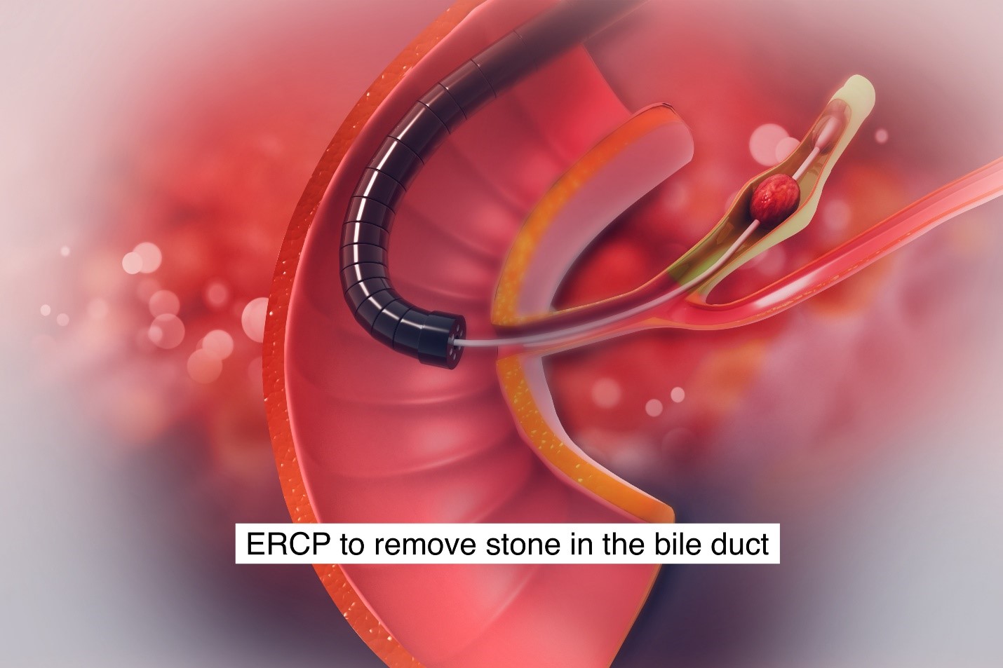 Acute Pancreatitis Treatment In Singapore | LS Lee Surgery Clinic